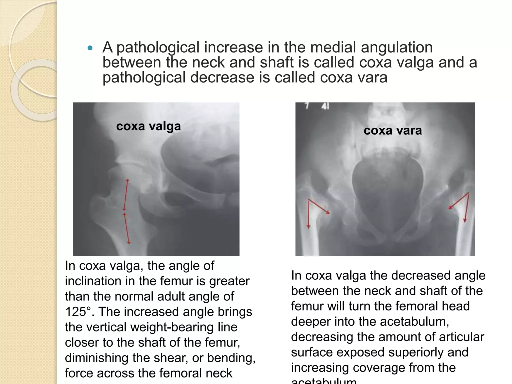 Hip joint biomecanics | PPTX