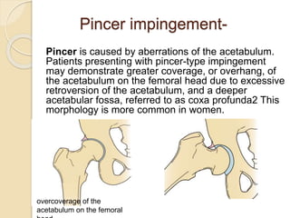 Hip joint biomecanics | PPTX
