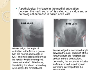 Hip joint biomecanics | PPTX