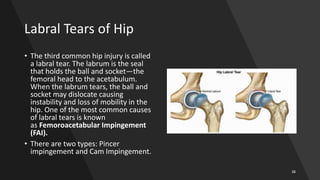hip joint biomechanics with well defined motions and range of motions | PDF