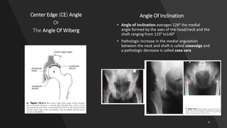 hip joint biomechanics with well defined motions and range of motions | PPT