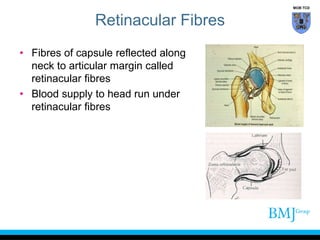 Hip_Joint_BMJ.ppt