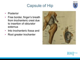 Hip_Joint_BMJ.ppt