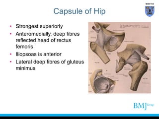 Hip_Joint_BMJ.ppt
