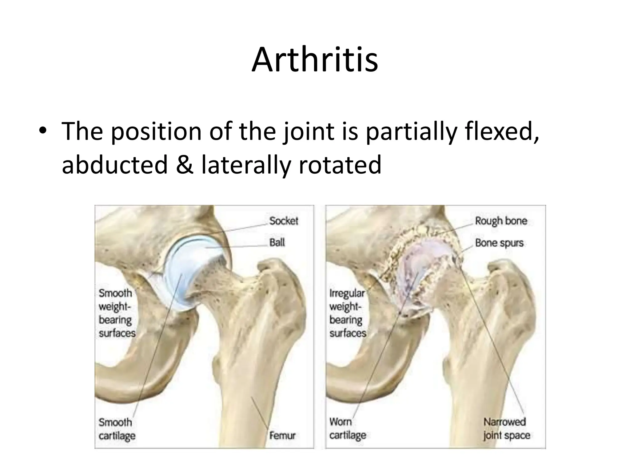 hip joint examination.pptx medical collage | PPTX