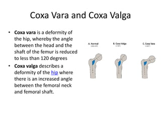 hip joint examination.pptx medical collage | PPTX