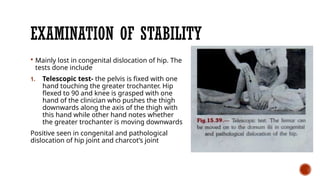 HIP JOINT EXAMINATION orthopaedis ppt.pptx
