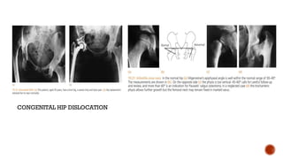 HIP JOINT EXAMINATION orthopaedis ppt.pptx