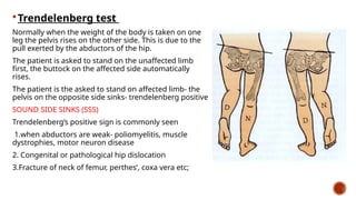 HIP JOINT EXAMINATION orthopaedis ppt.pptx