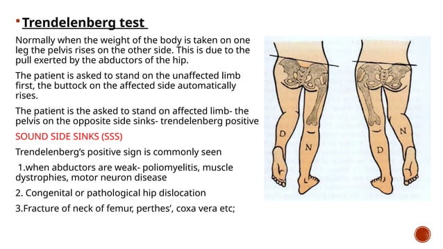 HIP JOINT EXAMINATION orthopaedis ppt.pptx