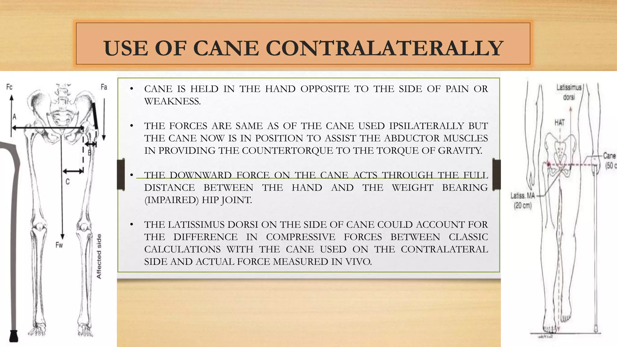 Hip joint forces and muscle function in stance | PPTX