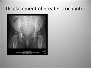 the gross antomy of the hip hoint and applied anatomy focused for ...