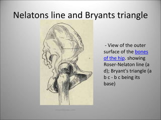 the gross antomy of the hip hoint and applied anatomy focused for ...
