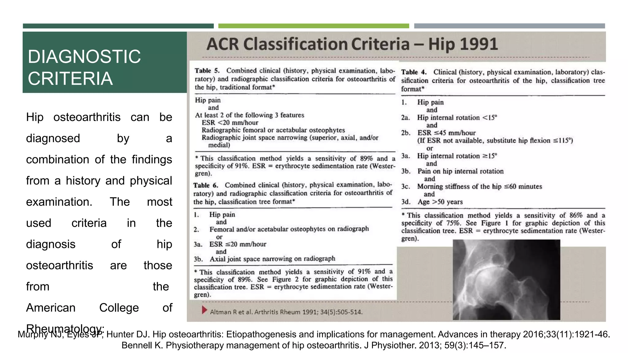 Hip osteoarthritis | PPTX