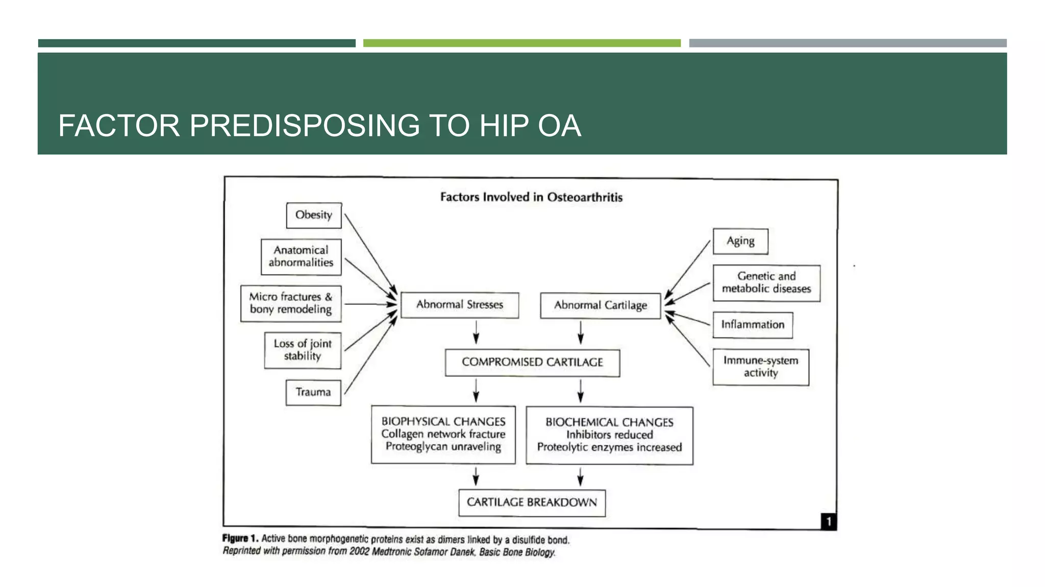Hip osteoarthritis | PPTX