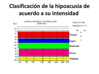 Hipoacusia laboral | PPT