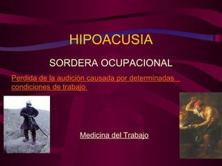 Trauma Acústico Crónico - Hipoacusia - Medicina Laboral | PPT