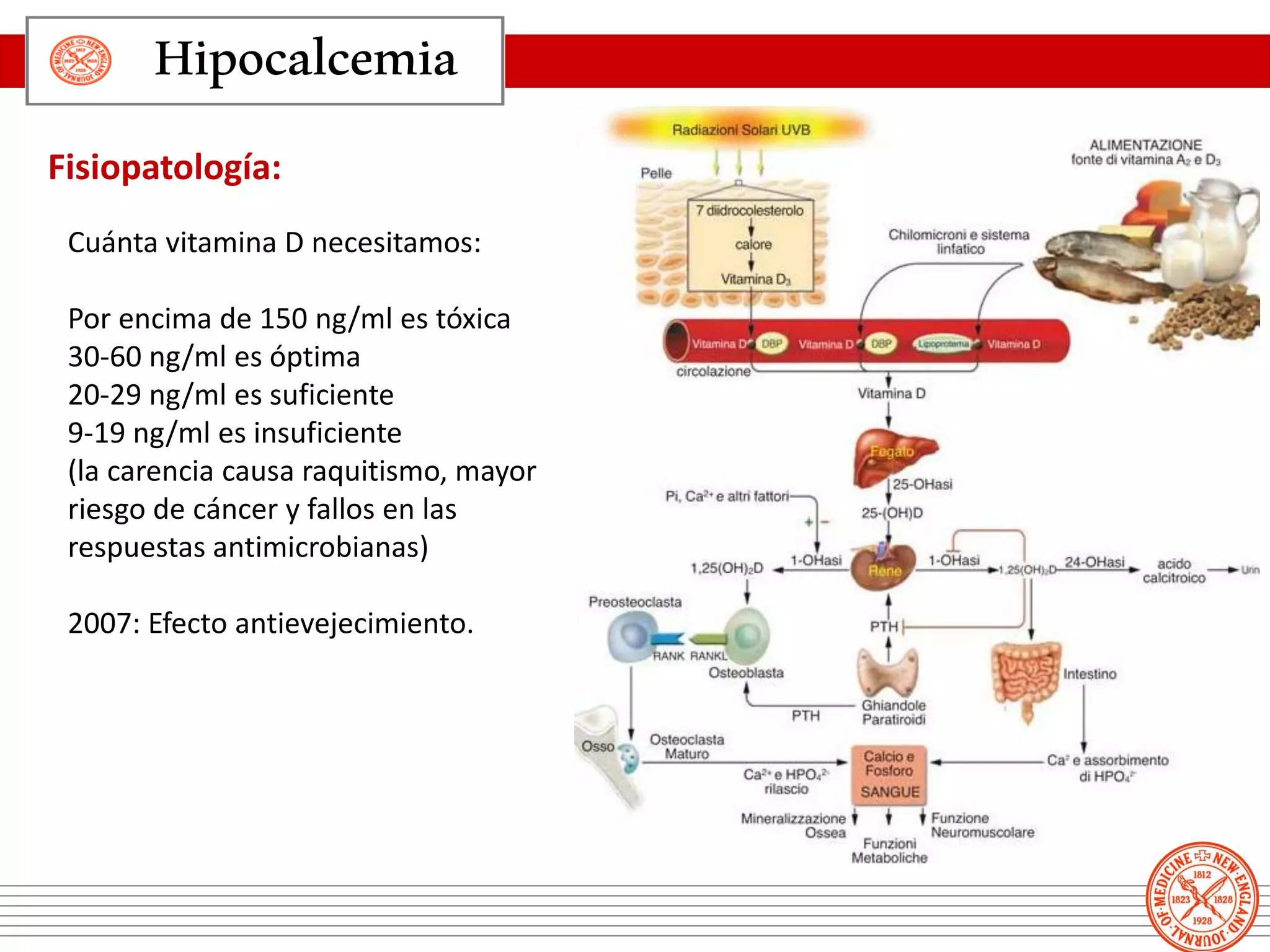 Hipocalcemia | PDF
