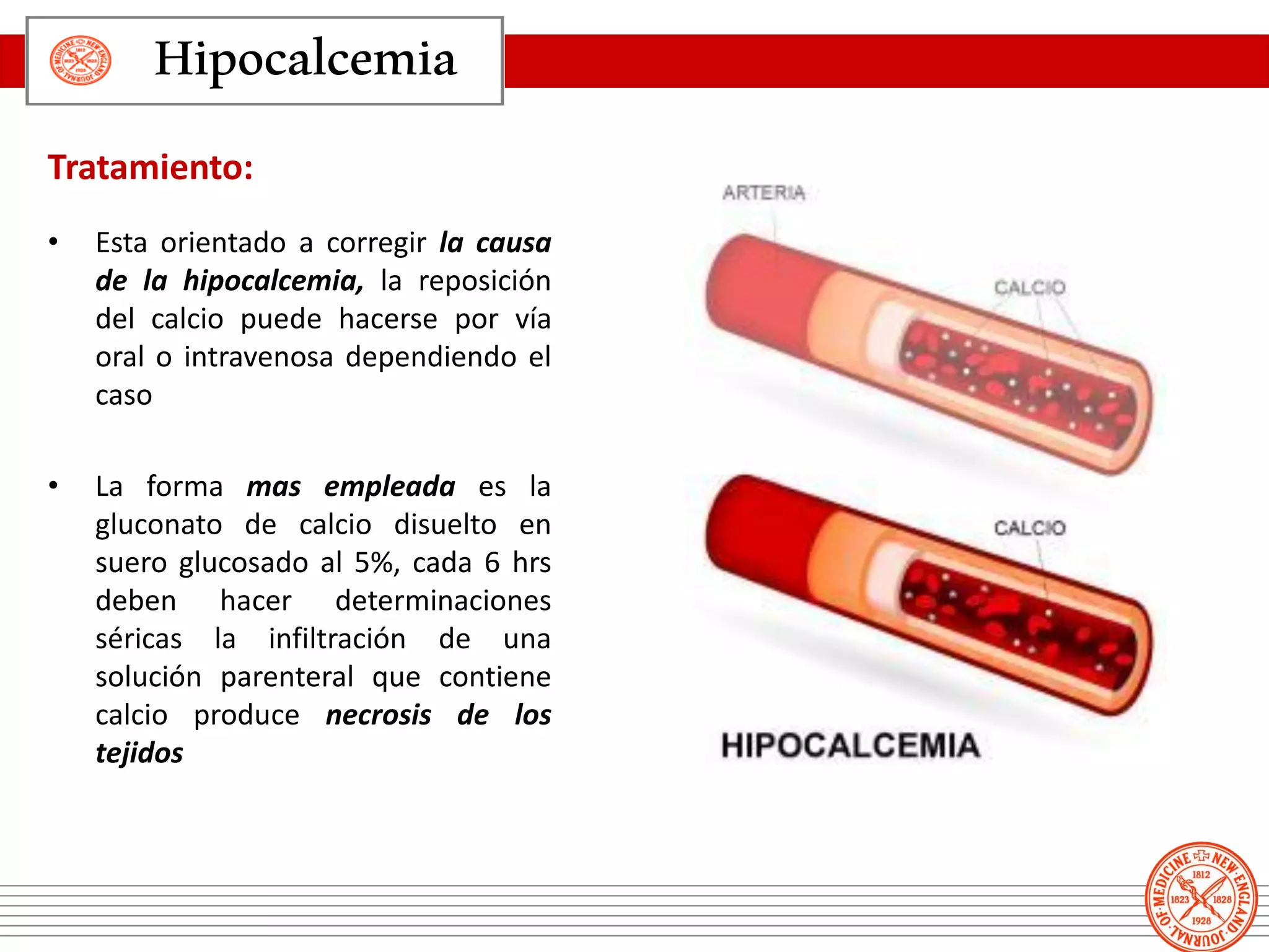 Hipocalcemia | PDF