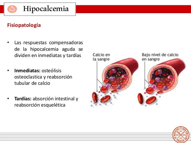 Hipocalcemia