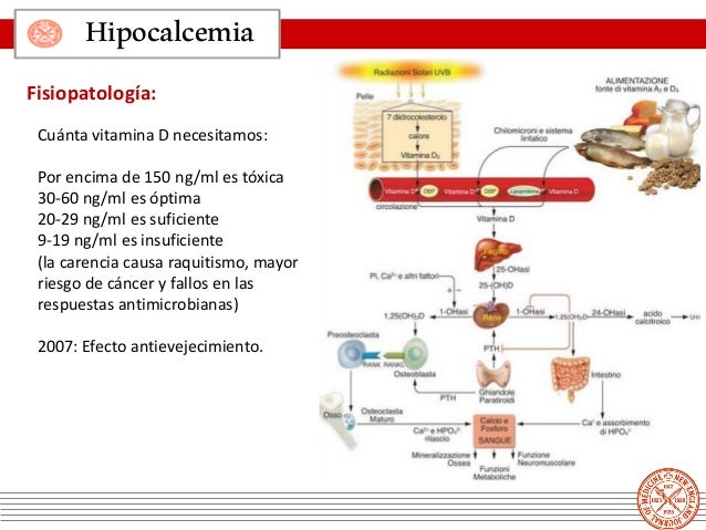 Hipocalcemia