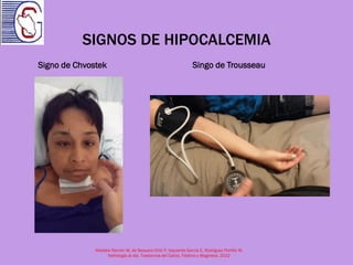 Hipocalcemia.pdf