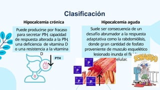hipocalcemia.pptx