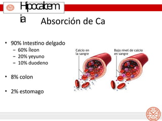 hipocalcemia, generalidades manejo guias | PPTX