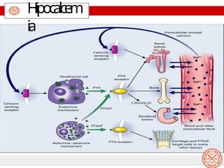 hipocalcemia, generalidades manejo guias | PPTX