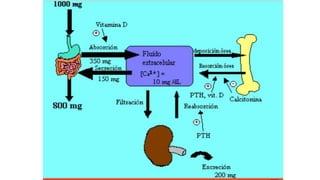 HIPOCALCEMIA | PPTX