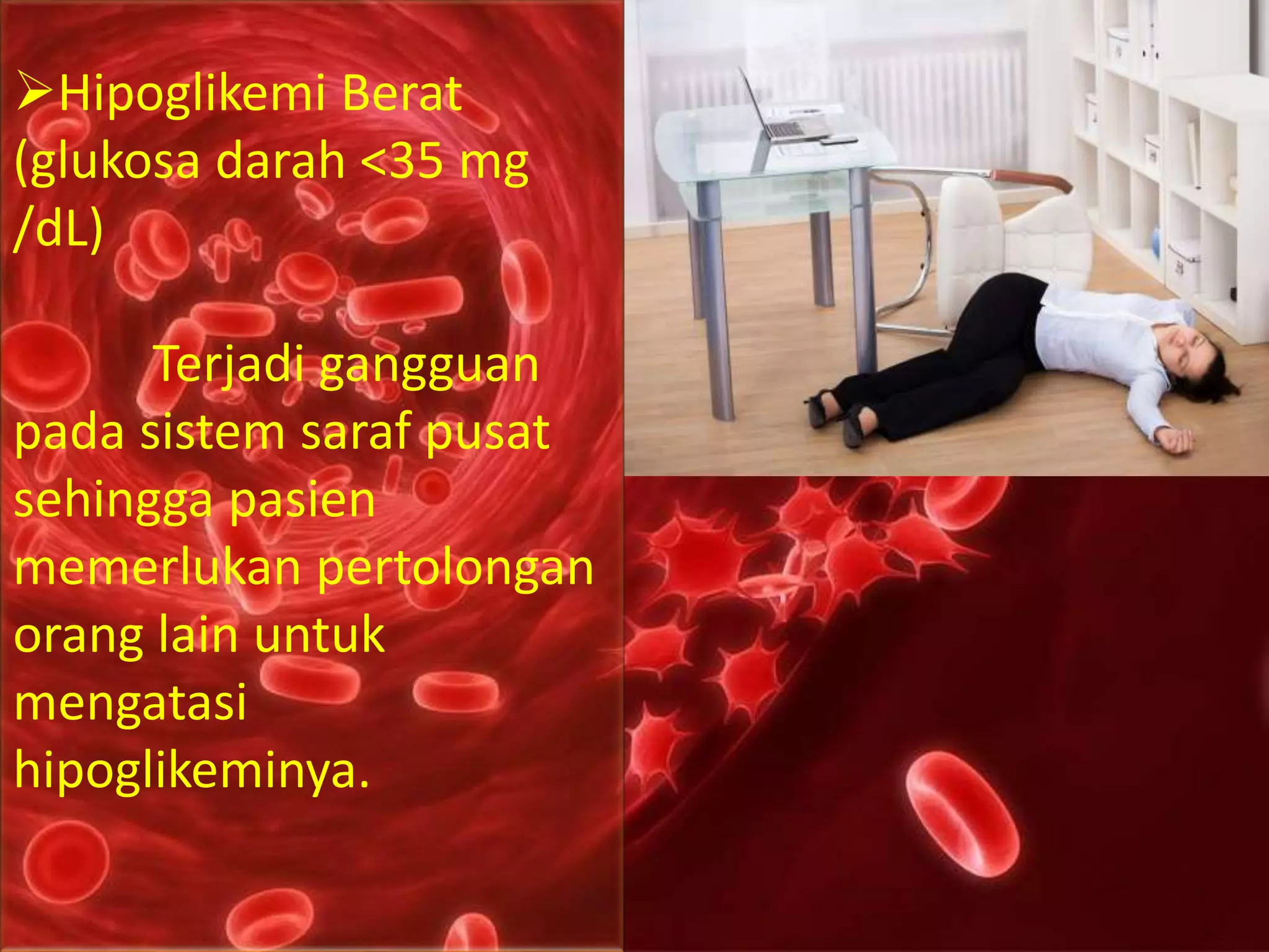Hipoglikemia.pptx