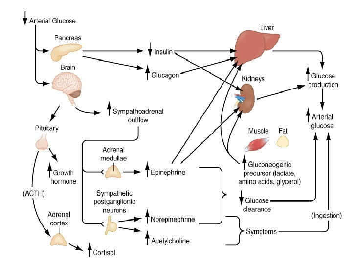 HIPOGLUCEMIA