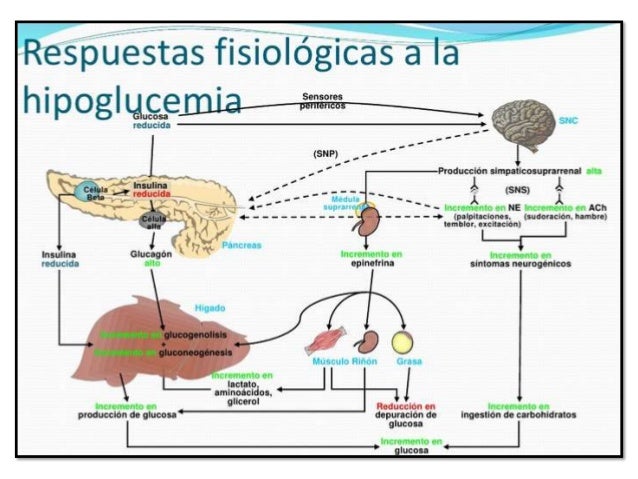 Hipoglucemia