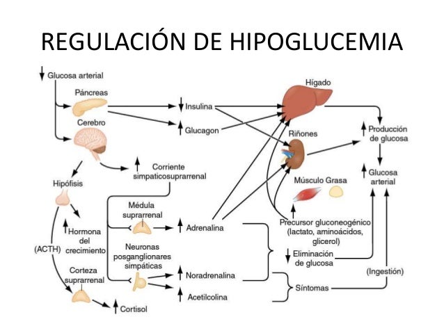 Hipoglucemia