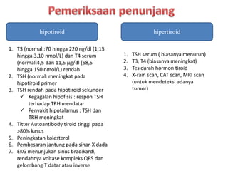 Hipo & Hipertiroid | PPTX