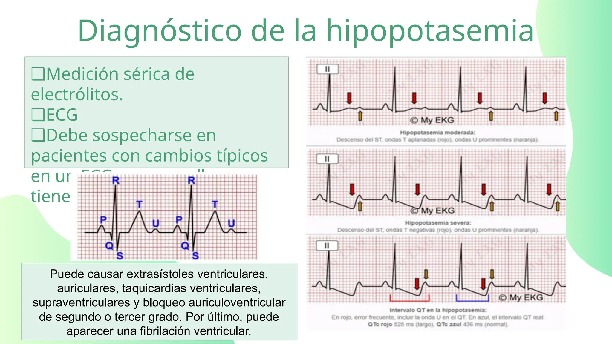 HIPOKALEMIA Y RESPOSICION DE POTASIO CASO CLINICO | PPT | Descarga Gratuita