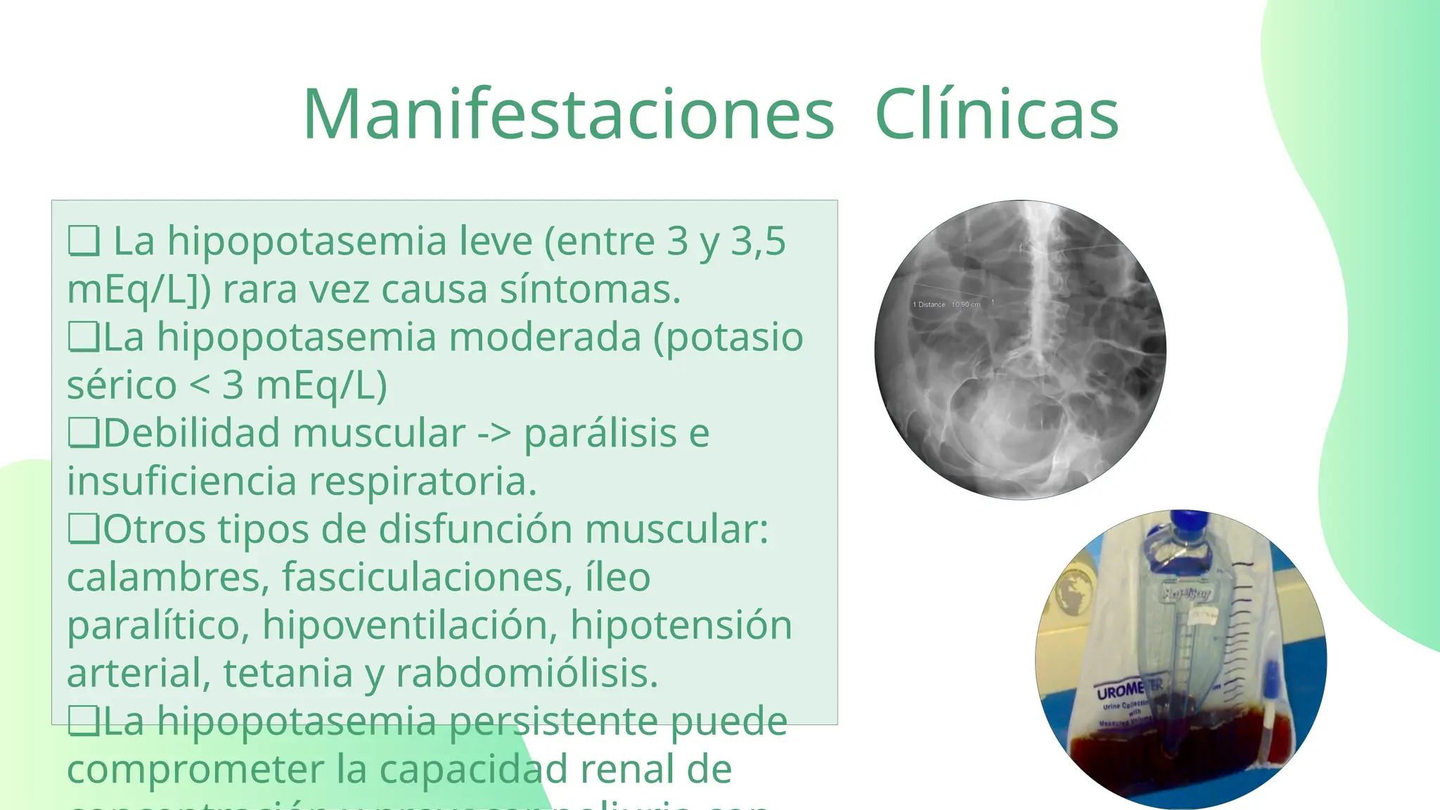 HIPOKALEMIA Y RESPOSICION DE POTASIO CASO CLINICO | PPTX