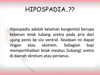 Hipospadia | PPTX