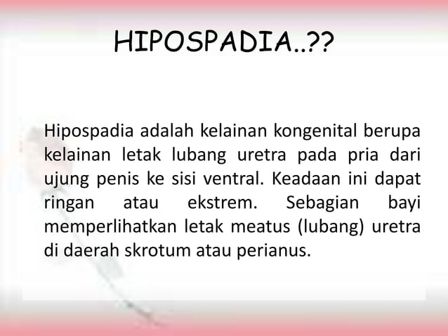 Hipospadia | PPTX