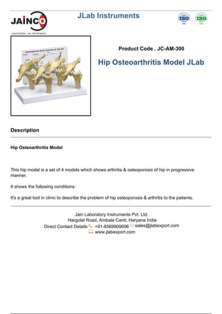 Hip osteoarthritis model | PDF