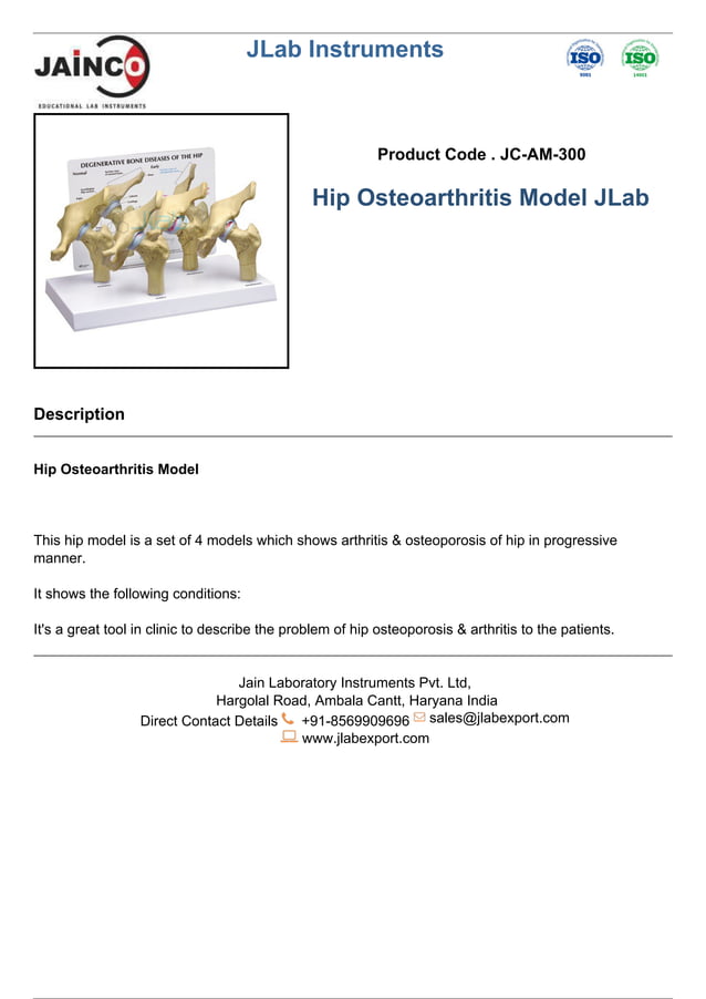 Hip osteoarthritis model | PDF