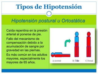 Hipotension shock | PPTX