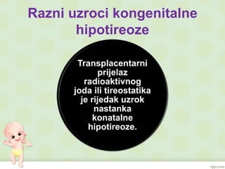 Hipotireoza | PPSX