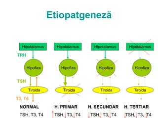 Prezentare hipotiroidism, curs de endocrinologie | PPT