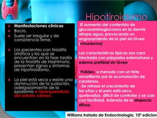Hipotiroidismo | PPTX