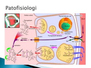 Hipotiroid Kongenital , dr. Spesialis Anak.pptx