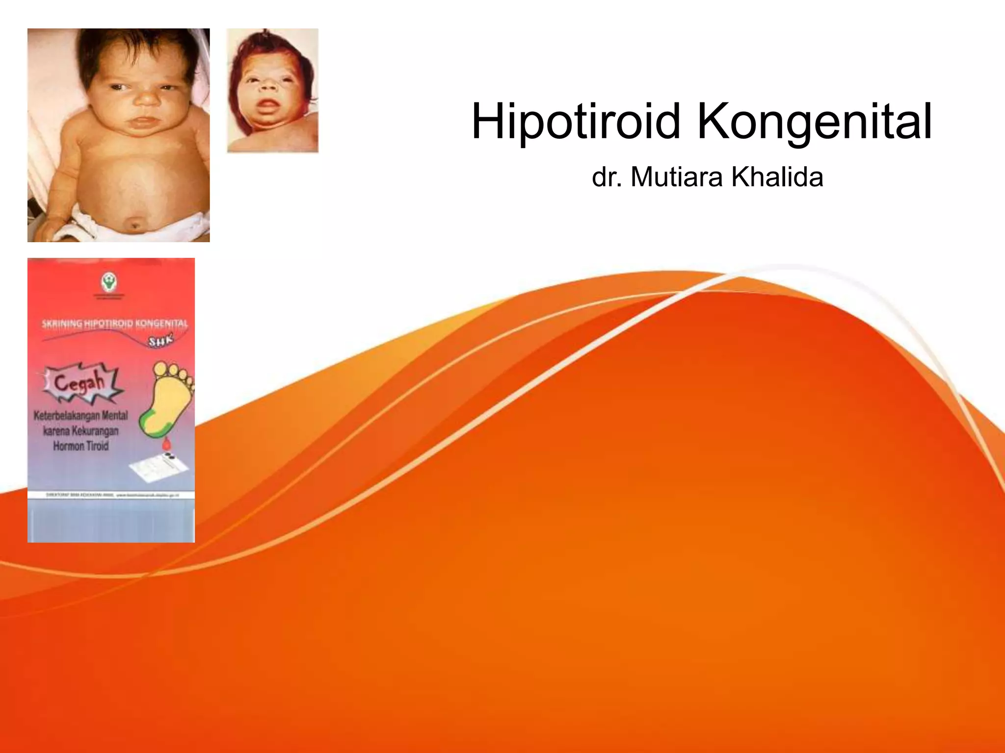 Hipotiroid_Kongenital_Pelatihan_SHK_fini.pptx