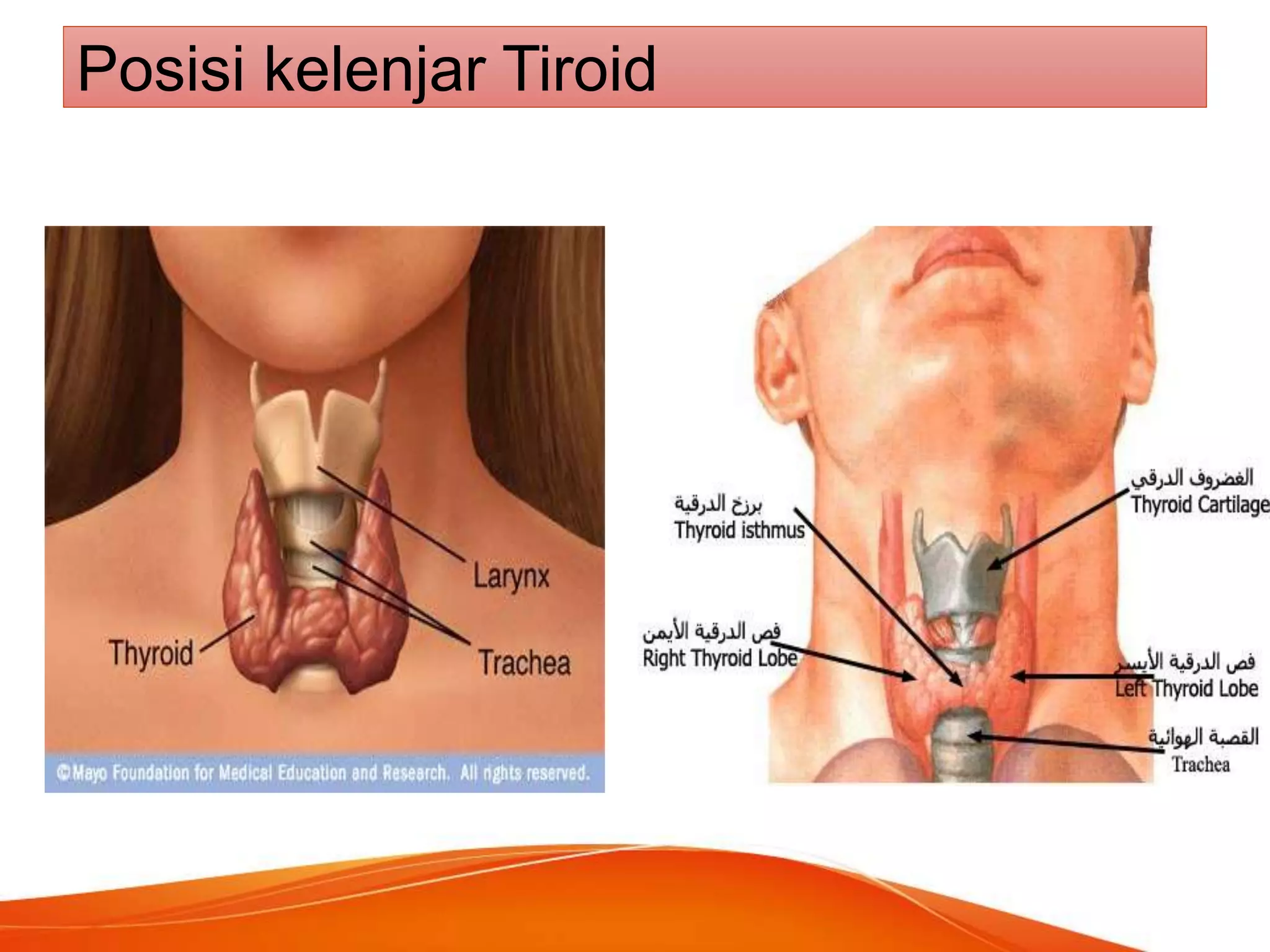 Hipotiroid_Kongenital_Pelatihan_SHK_fini.pptx