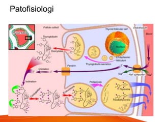 Hipotiroid_Kongenital_Pelatihan_SHK_fini.pptx
