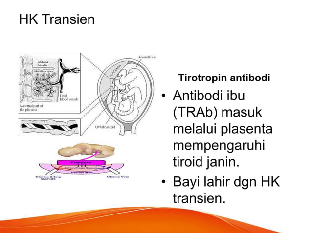Hipotiroid_Kongenital_Pelatihan_SHK_fini.pptx